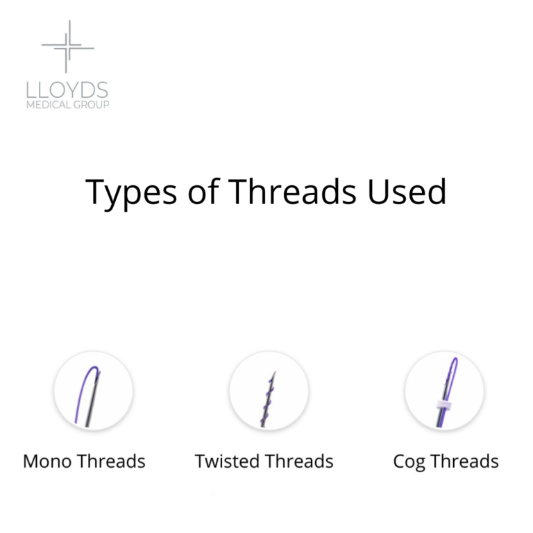 Thread Lift – Lloyds Medical Group